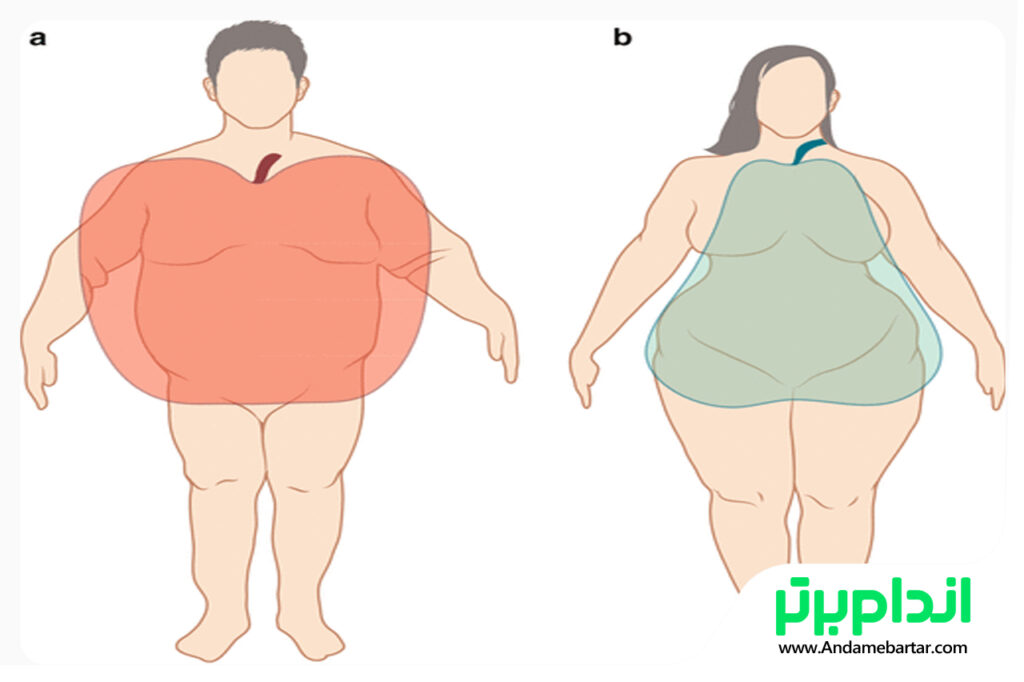 چاقی ژنوئیدی چیست؟ - اندام برتر
